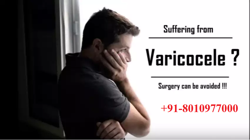 Varicocele Treatment Without Surgery In South Delhi 91 7042424269 Dr